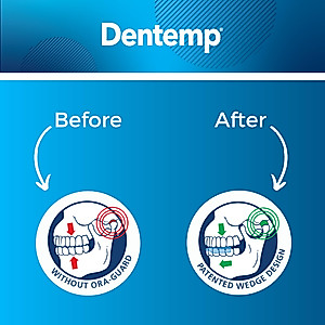 Dentemp Ora-Guard Custom Fit Dental Guard - Bruxism Night Guard for Teeth Grinding - Mouth Guard for Clenching Teeth at Night - Comfortable Mouth Guard for Sleeping - Relieve Soreness in Jaw Muscles…