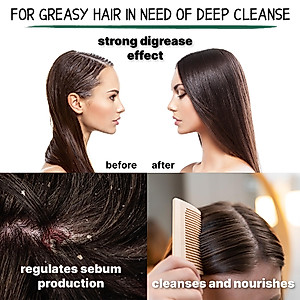 Nettle Shampoo - Helps Regulate Sebum Production, Reduce Dandruff & Ease Scalp Irritation - For Strong, Healthy Hair- 200ml