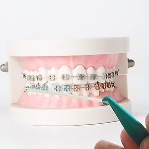 Orthodontic Elastic Rubber Bands, 500 Pack Medium Force Small Rubberbands Dreadlocks Hair Braids Fix Tooth Gap, Heavy 3.5 Ounce, 5 Pack Free Elastic Placer for Braces