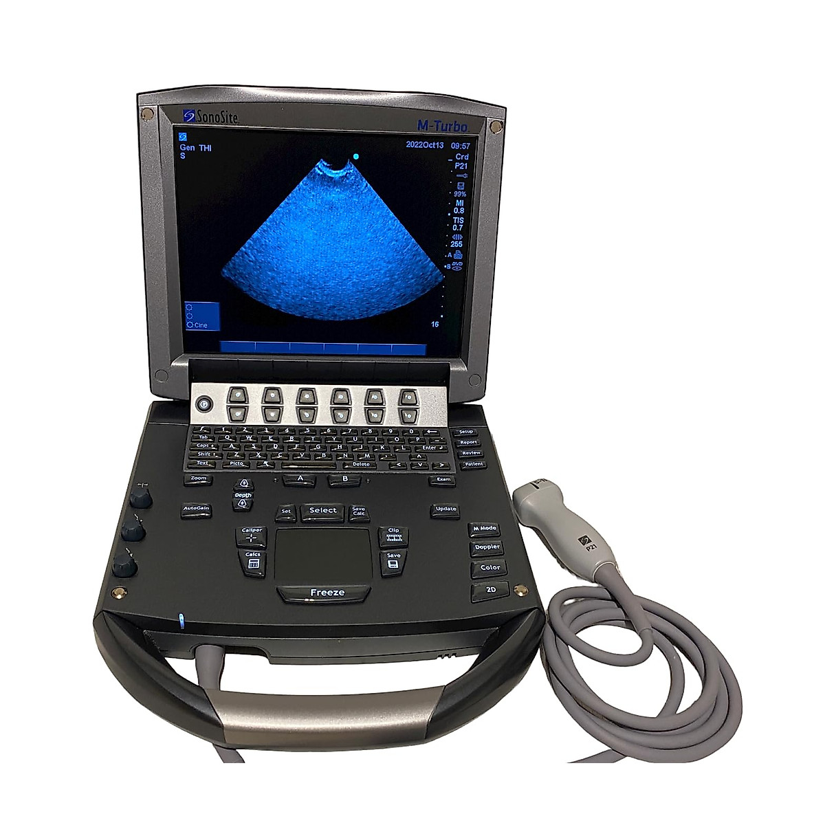 Sonosite M-Turbo Portable Ultrasound Machine