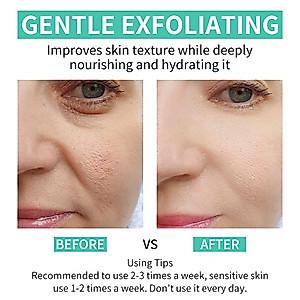 35% Glycolic Acid Pads for Face & Body, Exfoliating Facial Peel, AHA Resurfacing Pads with Vitamins B5, C & E, Green Tea, Glycolic Acid Peel Pads for Dark Spots Acne Fine Lines & Wrinkles 50 Pads