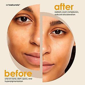 Artnaturals Kojic Acid Soap + African Net Sponge (2 pack X 142g Turmeric bars) Dark spot remover & Scars - Original Japanese Complex Vitamin C, Hyaluronic Acid, retinol, shea butter (Citrus)