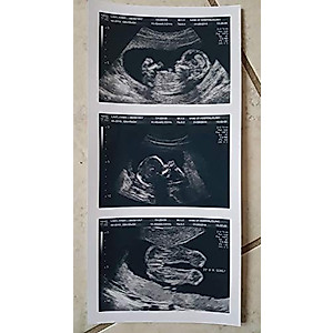 Prank 2D Customized Fake Ultrasound Strip of 3 Photos
