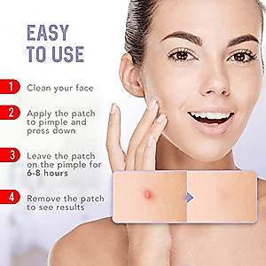 KEYCONCEPTS Pimple Patches (120 Pack), Salicylic Acid Acne Patches with Tea Tree Oil - Pimple Patches for Face - Zit Patch and Pimple Stickers - Salicylic Acid Acne Dots for Acne - Zit Patches