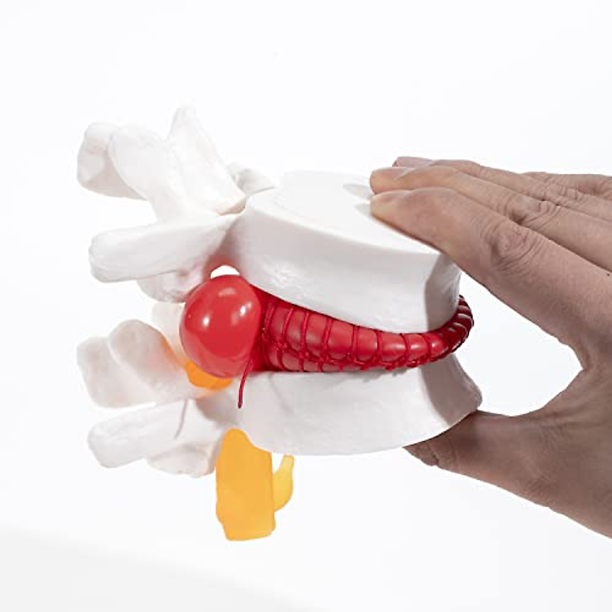 Human Anatomical Lumbar Disc Herniation Model - Lumbar Spine Model for Teaching & Learning - Excellent Way for Demonstrating Disc