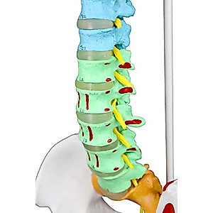 Vision Scientific VAV245 Flexible Spinal Column | 5 Color-Coded | Muscle W Occipital Bone | Sacrum, Coccyx, 24 Vertebrae, Soft Disc | Pelvic Bones & Femur Heads, Arteries, Nerve Endings | W Manual