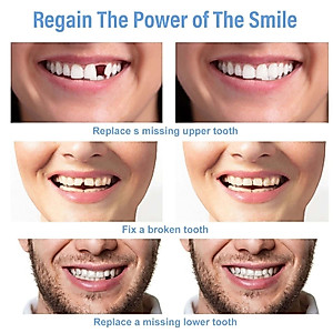 Renyqatt 2PCS Fake Teeth Adjustable Veneers Dentures Teeth for Women and Men Temporary Teeth Perfect Cover The Imperfect Teeth Nature and Comfortable (A)