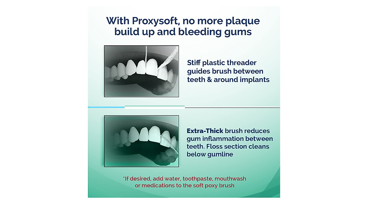 ProxySoft Periodontal Floss | Ultimate Dental Care
