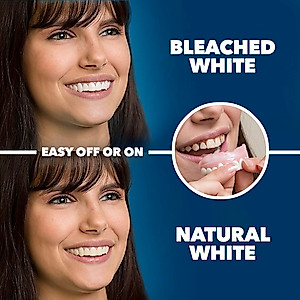 Imako Premium Cosmetic Teeth - 1 Pack - Large, Bleached White - Upper Veneers - Custom Fit at Home, DIY Smile Makeover - Made in USA