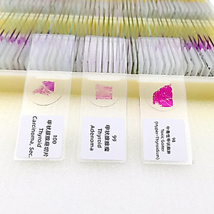 Human Pathological Section Prepared Tissue Specimen Slides 100pcs/box