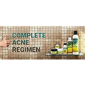 Acne Zap - Shampoo for Scalp Acne – Clear Scalp from Acne, Zits and Pimples 6.0 oz
