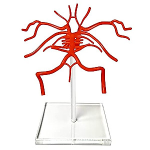Evotech Brain Artery Model, Life Size Intracranial Artery Model, Shows Internal Carotid Artery, Willis Circle and Basillary Artery & Their Branches. On a Plexiglass Base
