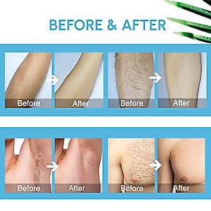 Hair Removal Spray Foam - Newest Formula from 100% Natural Ingredients - Effective & Painless - Cream - Body & Intimate Depilatory Spray Foam for Women & Men