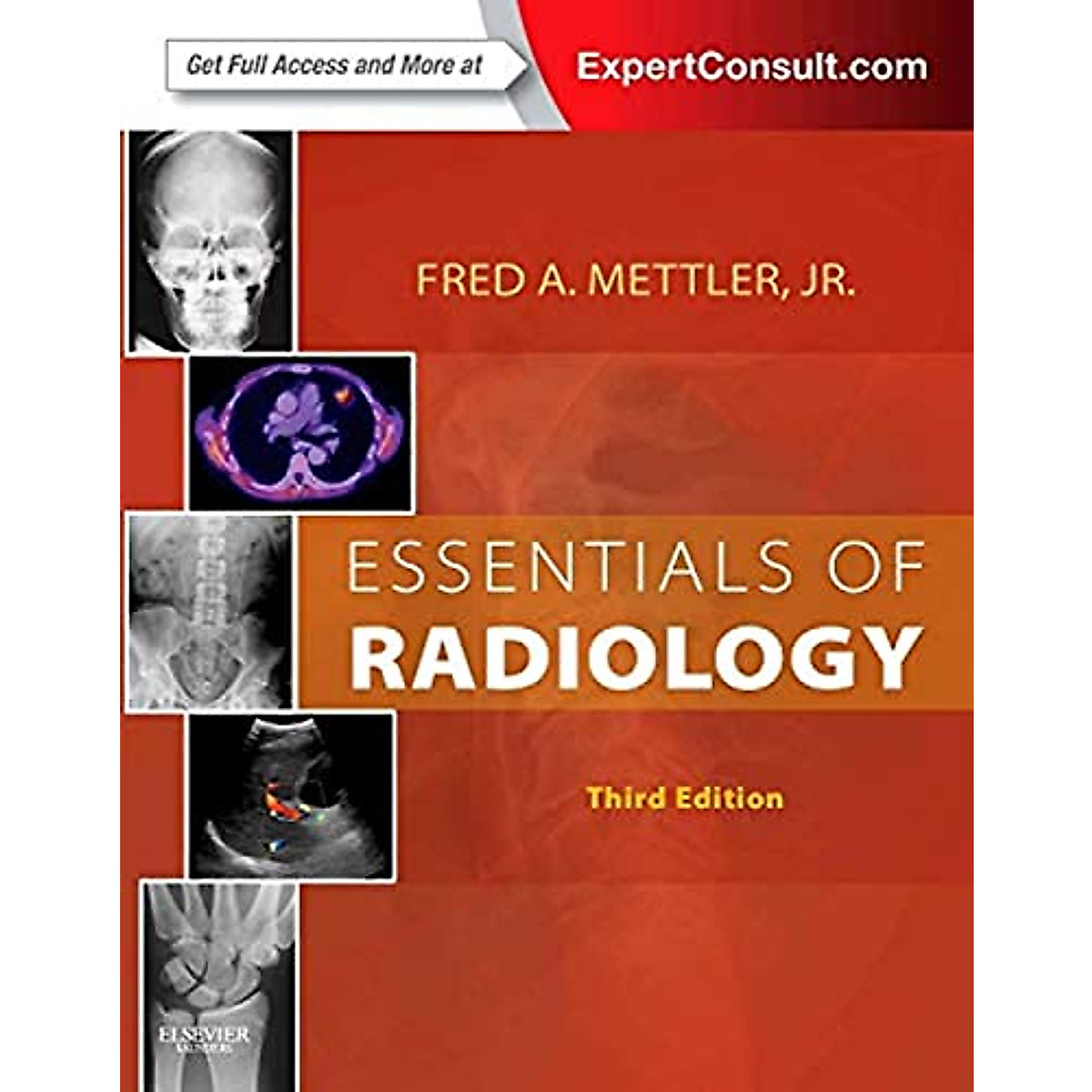 Essentials of Radiology: Common Indications and Interpretation (Mettler, Essentials of Radiology)