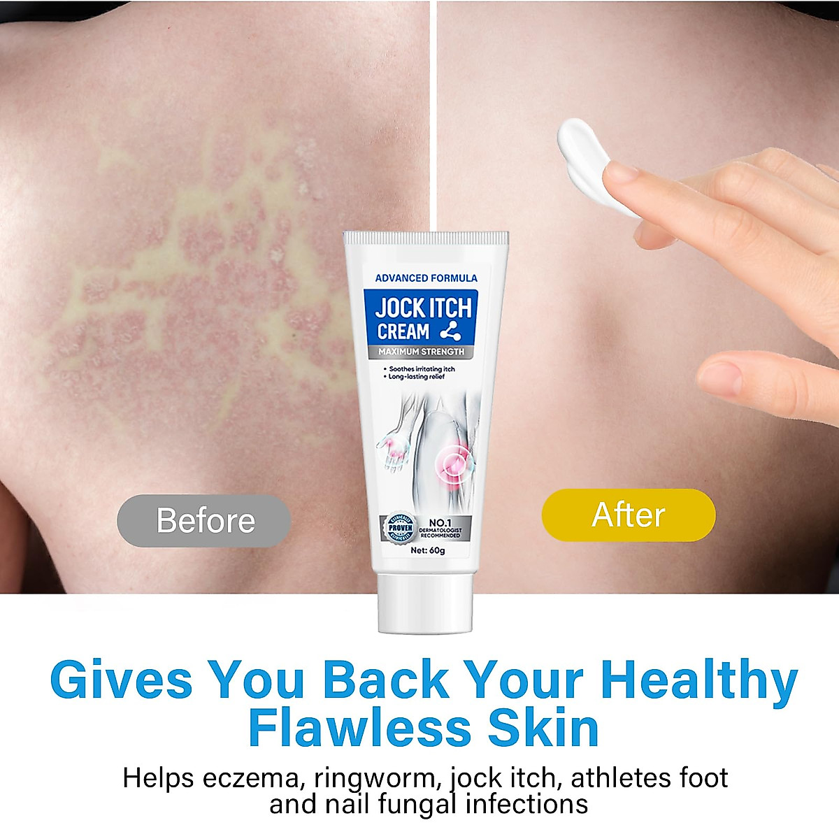 iTecFreely Jock Itch Cream, Powerful & Fast Jock Itch Cream, Jock Itch Care Extra Strength for Men & Women, Tinea Corporis, Itch Cream- 60g