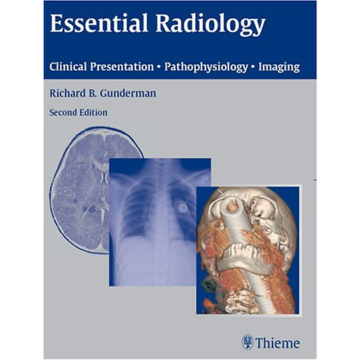 Essential Radiology: Clinical Presentation · Pathophysiology · Imaging