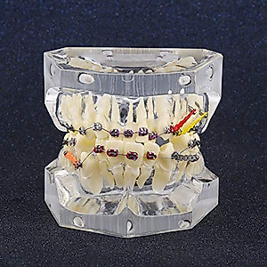 Teeth Educational Model Dental Treatment Malocclusion Study Demonstration Teeth Model with Wire Chain Orange