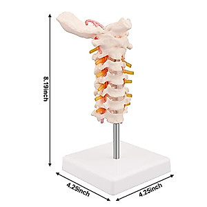 Ultrassist Cervical Spine Model with Cervical Vertebrae, Cervical Nerves, Vertebral Arteries & Occipital Plate for Medical Education