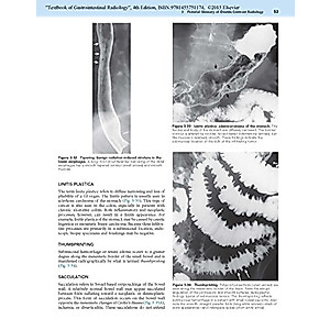 Textbook of Gastrointestinal Radiology, 2-Volume Set