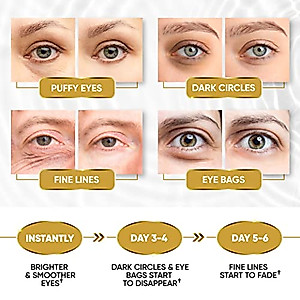 24K Gold Under Eye Mask - 25 Pairs for Puffy Eyes, Dark Circles, Eye Bags, Puffiness with Collagen and Vitamins - Natural Anti-Aging Eye Pads - Hydrating Under Eye Patches - Golden Under Eye Gel Pads