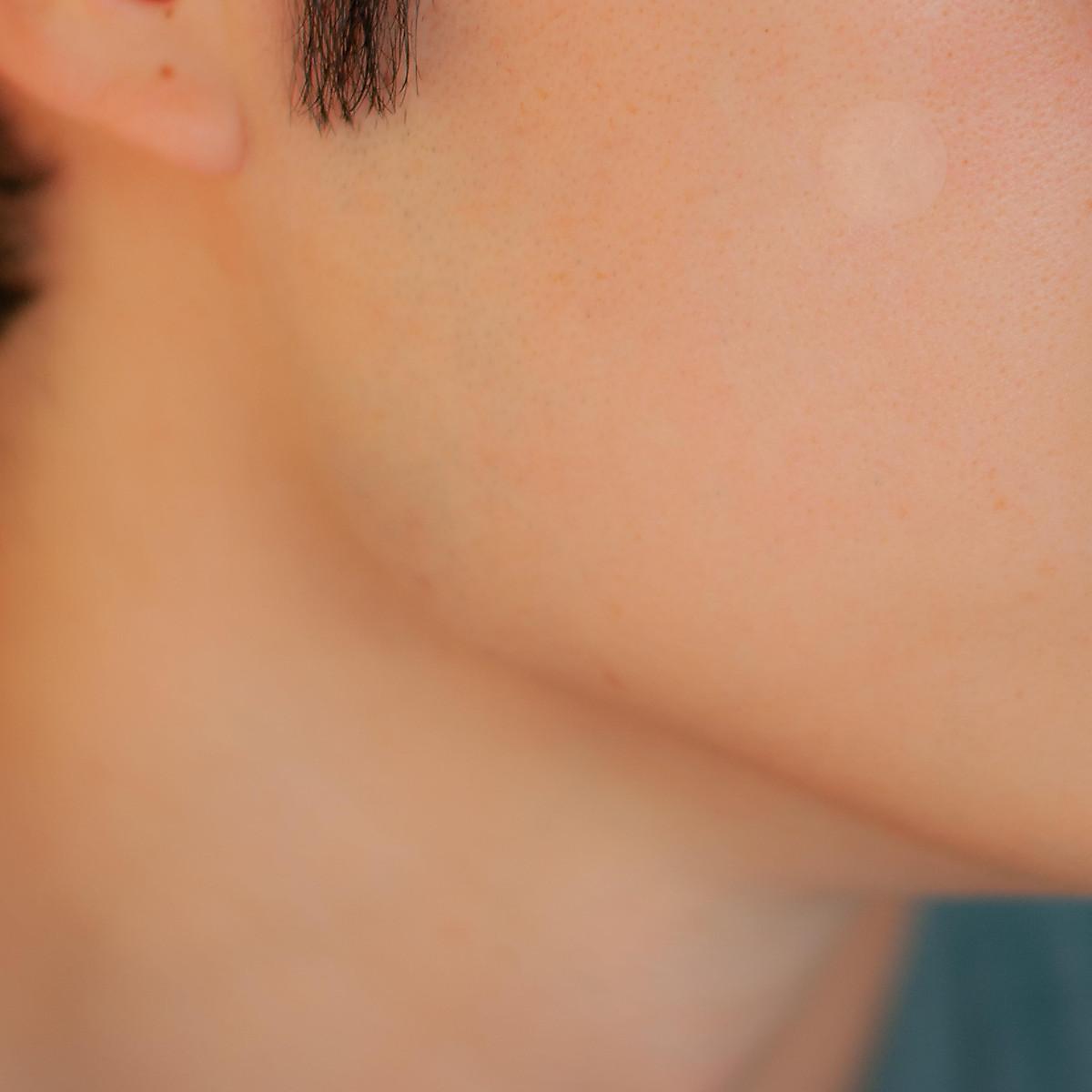 SMARTMED Cover Dot Acne Care (120 Dots) Skin Blemish Treatment with Hydrocolloid | Clear, Waterproof Patch | Oil and Pimple Absorbing | Made in USA