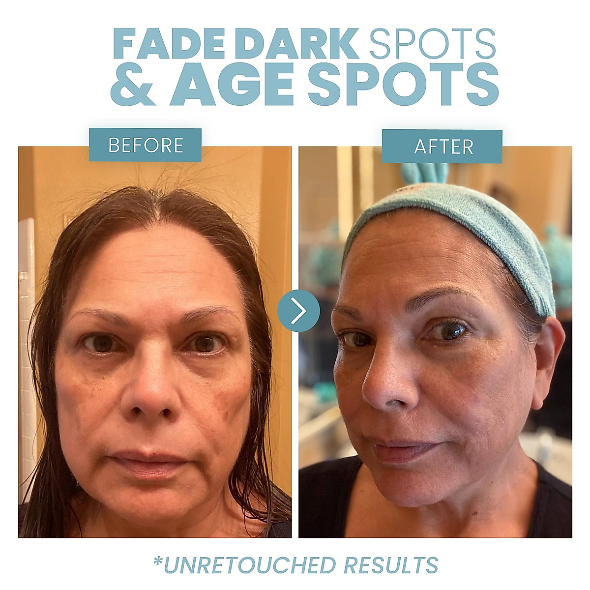 Vitamin C Serum 20% For Face, Pure Vitamin C Face Serum for Wrinkles, Acne, Dry Skin, and Dark Spots - Facial Vitamin C Serum (1oz)