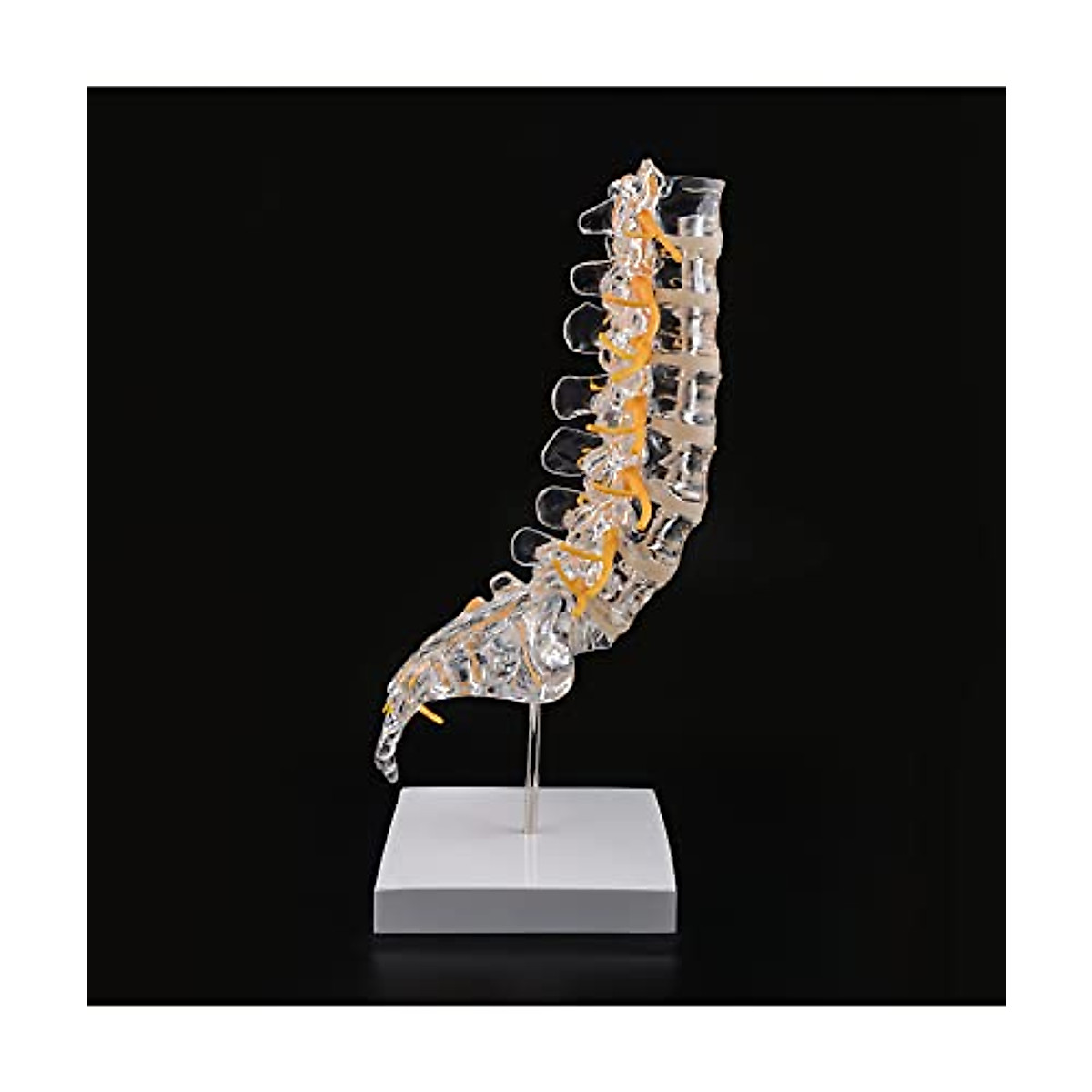 Ultrassist Human Lumbar Spine Model with Sacrum, Spinal Nerves and Herniation Disc, Includes Base for Display, Life Size Spine Model for Medical Education