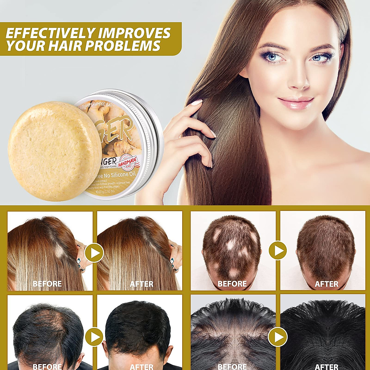 Ginger Hair Regrowth Shampoo Bars - Pack of 5, Promotes Hair Growth, Natural Organic Anti-Dandruff and Anti-Itching Ginger Soap