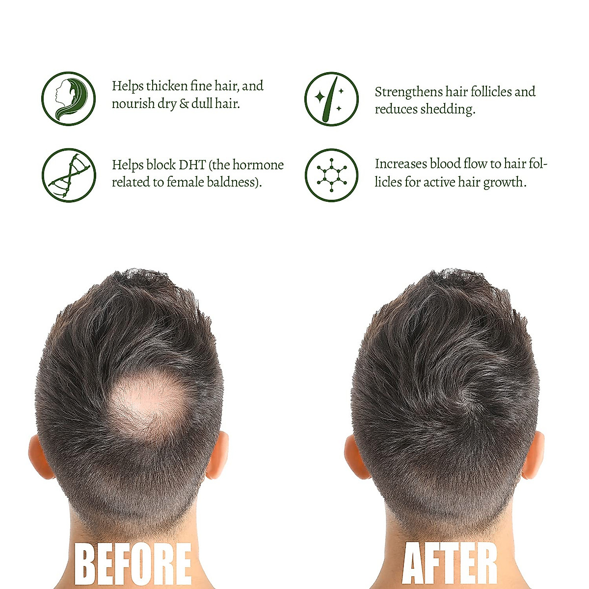 ATIVO WELLNESS Sangre De Grado Hair Growth Shampoo with Rosemary and Nettle Extract-500ml