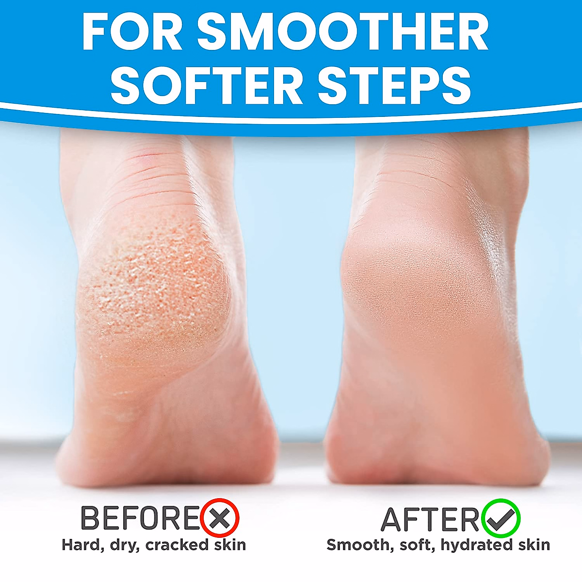 [5PCS Made In Korea] KN FLAX Madforcos Foot moisturizing Mask - Removes Dead Skin for Softer And Smoother Feet - Repairs Rough Heels And Dry Toe Layers - Natural Exfoliation Treatment To Uplift And Rejuvenate Safely