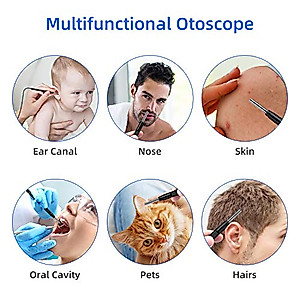 Jiusion 3.9mm Ultra-Thin Portable USB Digital Otoscope Camera with Carrying Case, HD 720P 6 LED Visual Ear Scope with 3 Hats 2 Silicone Caps 8 Earwax Spoons for Android Windows Mac NOT for iPhone iPad