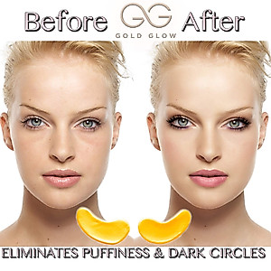 Gold Glow 24k Collagen Under Eye Gel Patches, Reduces Puffiness, Dark Circles, Anti Wrinkle, Anti Aging Gold Eye Mask, Hydrogel, Undereye Bags Treatment, Puffy Eye Pads for Men Women (30 Pairs)