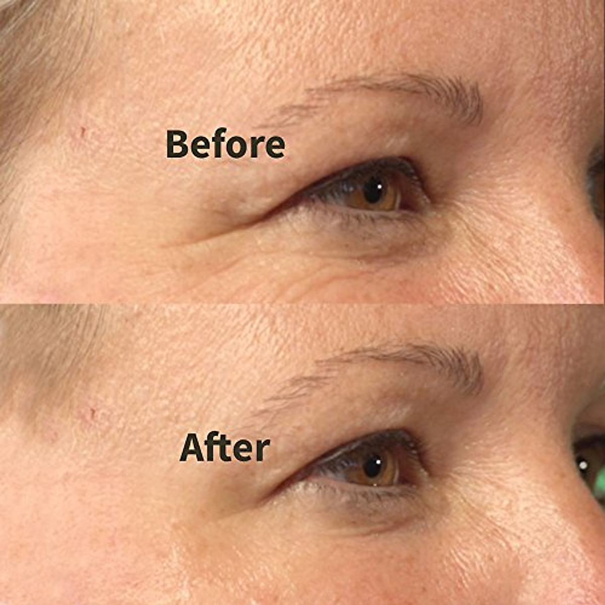 Instant Firming Maxi Lift Serum - Two Minute Face Lift For A Younger Look