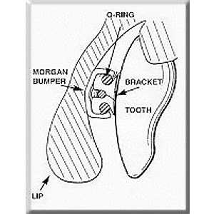 Morgan Bumper Braces Cover Lip Protector Qty 2 - Clear