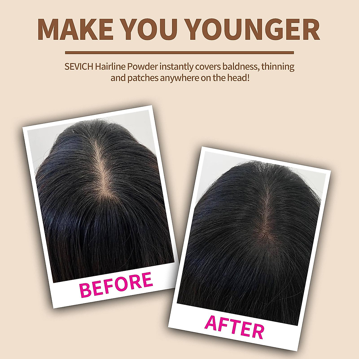 Sevich Hairline Powder，Instantly Conceals Hair Loss, Root Touch up Powder, Hair Shadow Toppers for Women & Men, Touch Up for Thinning Gray Hair, Windproof & Sweatproof, Medium Brown