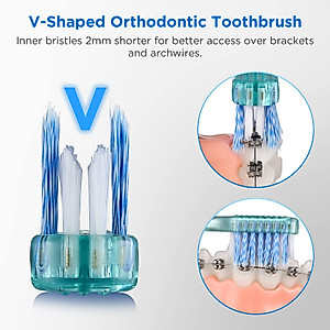 Fregum V-Shaped Orthodontic Toothbrush for Braces, with 6 Interdental Brushes, Soft Bristles, 6 Count