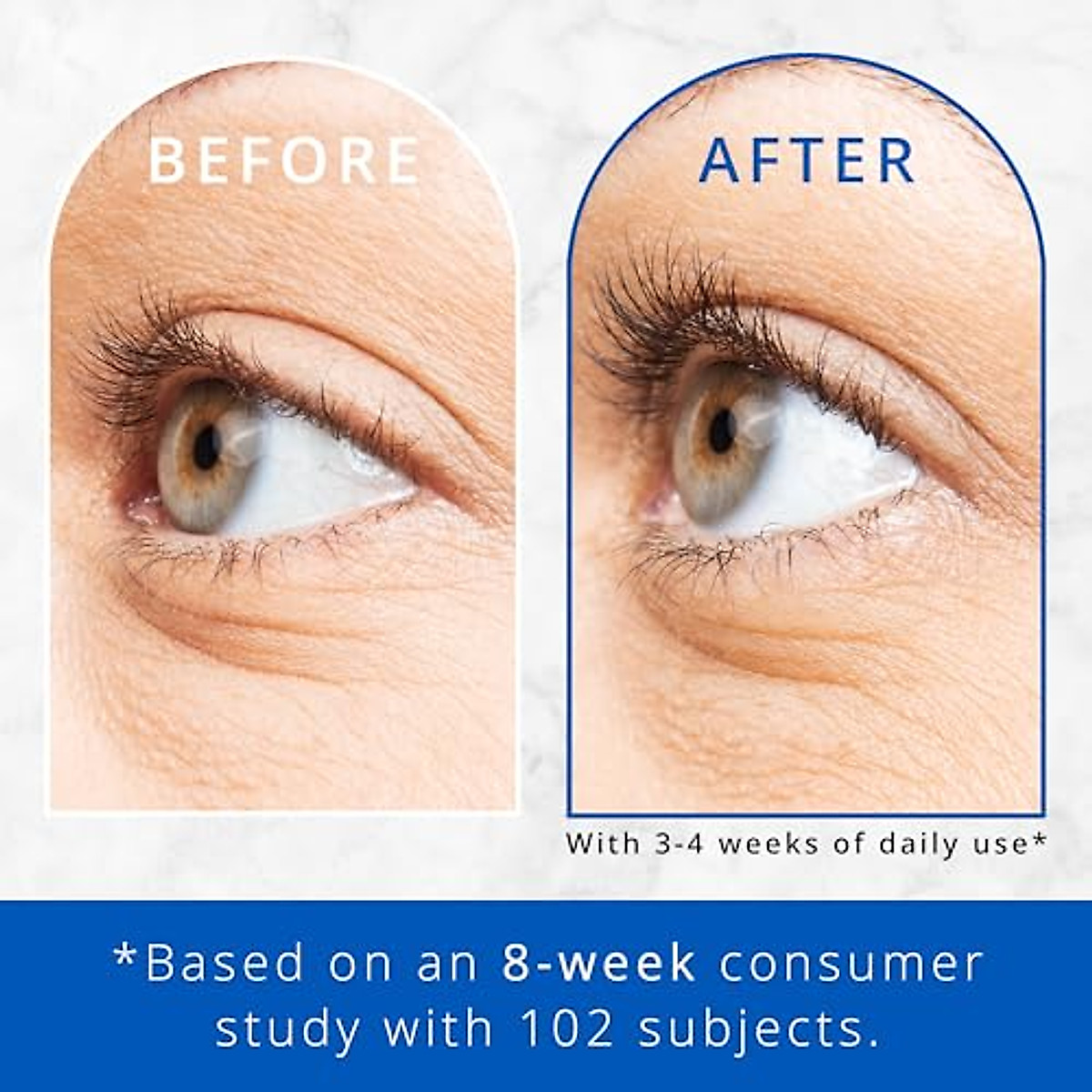 Eye Lash Enhancing Serum for Thicker, Longer Looking Lashes - neuLASH Eyelash Serum by Skin Research Laboratories - Advanced Formula Improves the Look of Natural Lash Follicles & Healthy Lash Lines