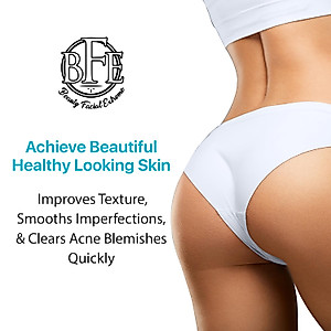 Anti-Acne Buttocks & Thigh Treatment- Clears Away Acne, Pimples, and Ingrown Hairs for the Buttocks and Thigh Area. Prevents Future Breakouts. 6.9 OZ