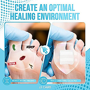 JJ CARE Sterile Gauze Pads 2" x 2" (Pack of 100), 12-Ply Cotton Gauze Pads, Individually-Wrapped Sterile Gauze Sponges, 100% Woven, Non-Stick Medical Gauze Pads for First Aid Kit & Wound Care