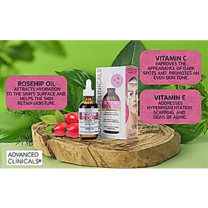 Advanced Clinicals Rosehip Oil Facial Skin Care Serum Moisturizer Face Oil W/Vitamin C & Vitamin E For Reducing Appearance Of Sun Damage Skin, Age Spots, & Wrinkles, 1.8 Fl Oz (Pack of 2)