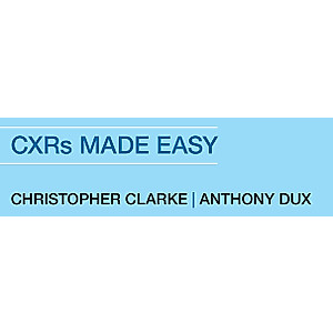 Chest X-Rays for Medical Students: CXRs Made Easy