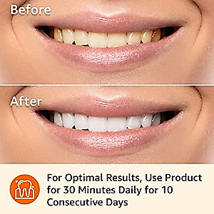 Amazon Basics 10 Day Teeth Whitening Strips Kit, 10 Treatments, 1-Pack (Previously Solimo)