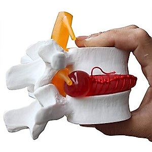 Doc.Royal Anatomical Human Lumbar Vertebrae Degenerative Lumbar Human Spine Model 1PCS