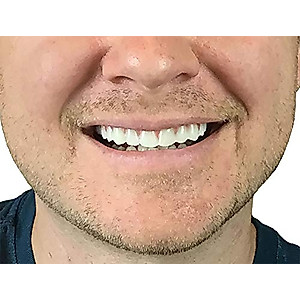 2 Pack - Instant Smile Natural Shade Comfort Fit Flex Veneers - Fix Your Smile from The Comfort of Your own Home in just Minutes! Hand Crafted