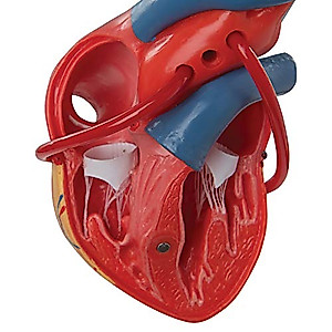 3B Scientific G05 Classic Heart w/ Bypass 2-part - 3B Smart Anatomy