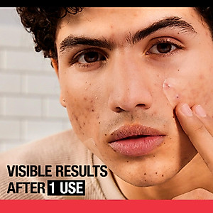 Neutrogena Stubborn Acne Pimple Patches, Acne Treatment for Face, Ultra-Thin Hydrocolloid Patches Provide Optimal Healing for Pimples, 2 Sizes, 10 Patches