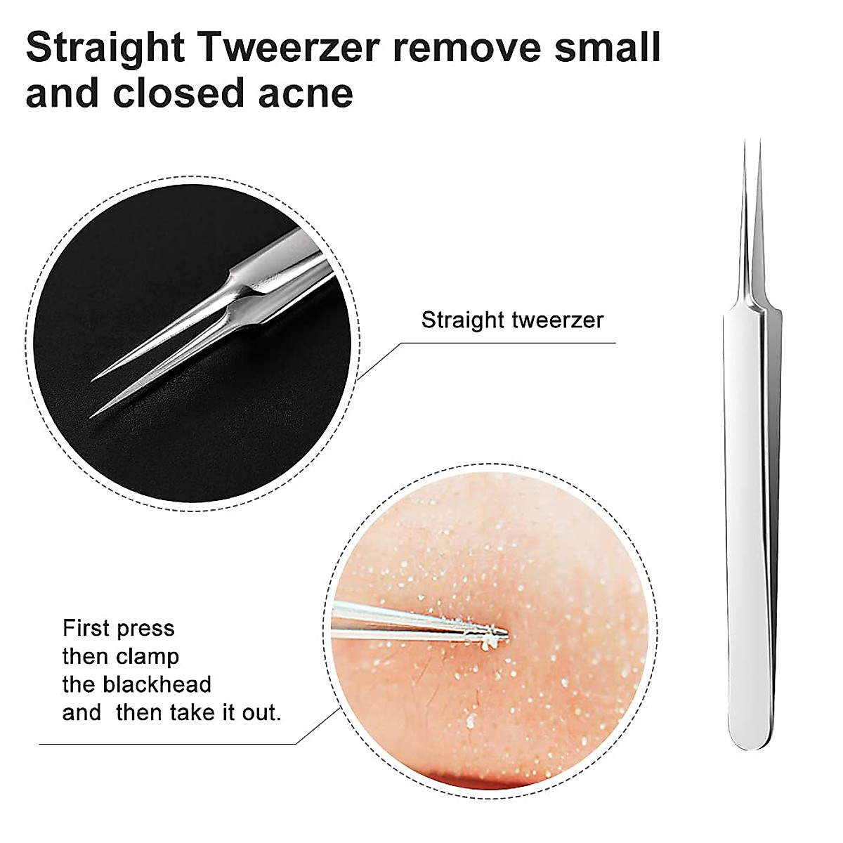 La Chat Blackhead Remover Kit - Blackhead Tweezers Removal Tool 3 pcs Comedone Pimple Extractor Tool, Acne Blemish Kit for Blackhead, pimple Tool, Curved Blackhead Tweezers kit (3 pcs)