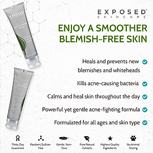Exposed Skin Care Acne Treatment Serum Step 3 – Quickly Reduces Pimple Size and Redness - 12 Hour Spot Treatment - 3.5% Benzoyl Peroxide, Natural Green Tea & Tea Tree Oil