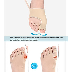 Bunion Corrector, Bunion Pain Relief Splint, Big Toe Straightener Pain Relief for Women & Men, Day Night Support