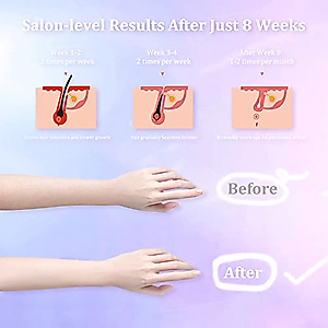 Laser Hair Removal for Women and Men, Permanent Ipl Hair Removal Device with 999,900 Flashes,9 Energy Levels Hair Removal Tool for Facial Legs Arms Whole Body(White)